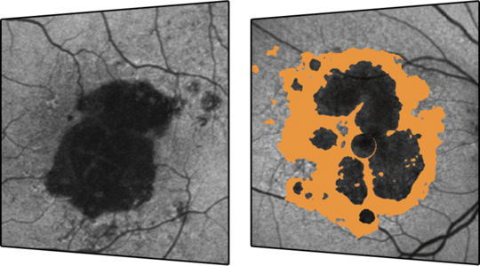 SPECTRALIS OCT - The ophthalmic Imaging Platform | Heidelberg Engineering