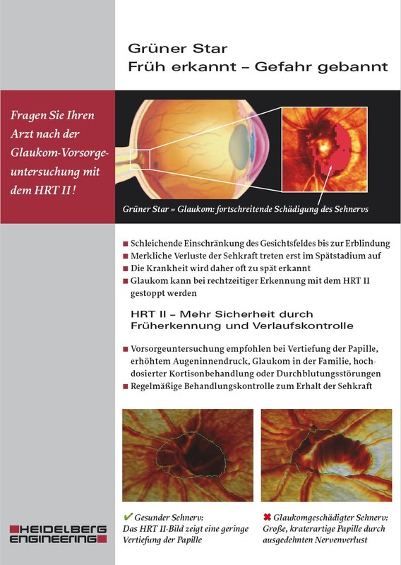 Practice Marketing Tools for Patient Education | Heidelberg Engineering