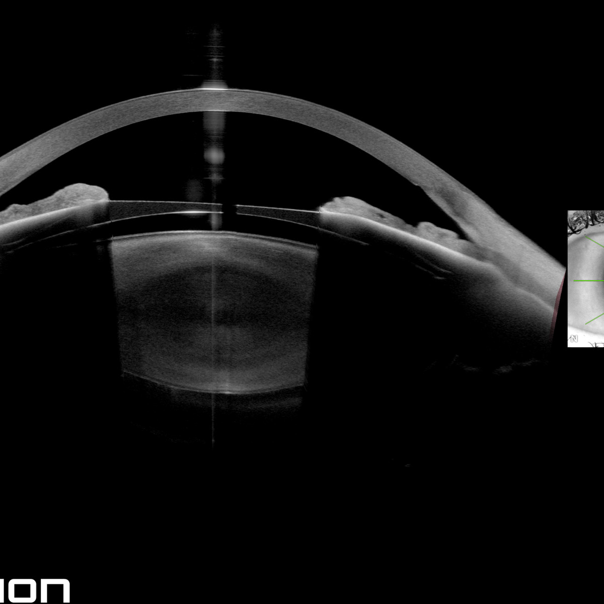 Imaging App - Multi-modal imaging platform optimized for the anterior ...