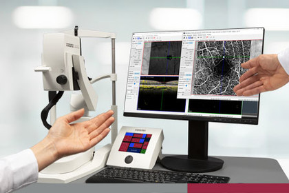 Medical Devices for Ophthalmologists / Optometrists | Heidelberg ...