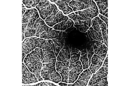Medical Devices for Ophthalmologists / Optometrists | Heidelberg ...