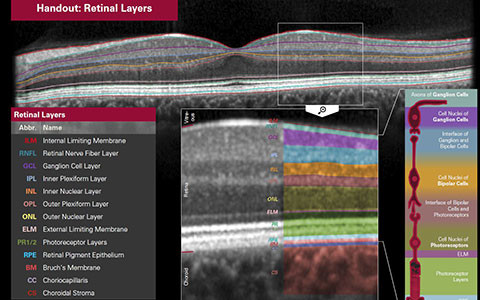 Downloads - SPECTRALIS OCT - The modular Imaging Platform | Heidelberg ...